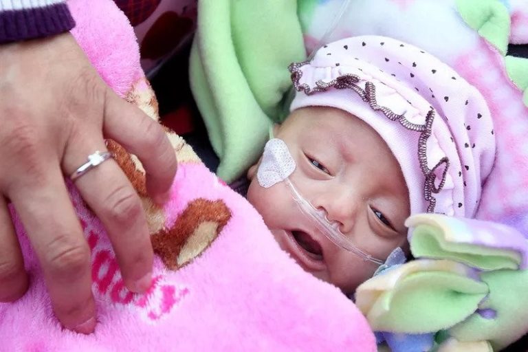 8 Youngest Premature Baby to Survive in History - Oldest.org 8 Youngest Premature Baby to Survive in History - Oldest.org