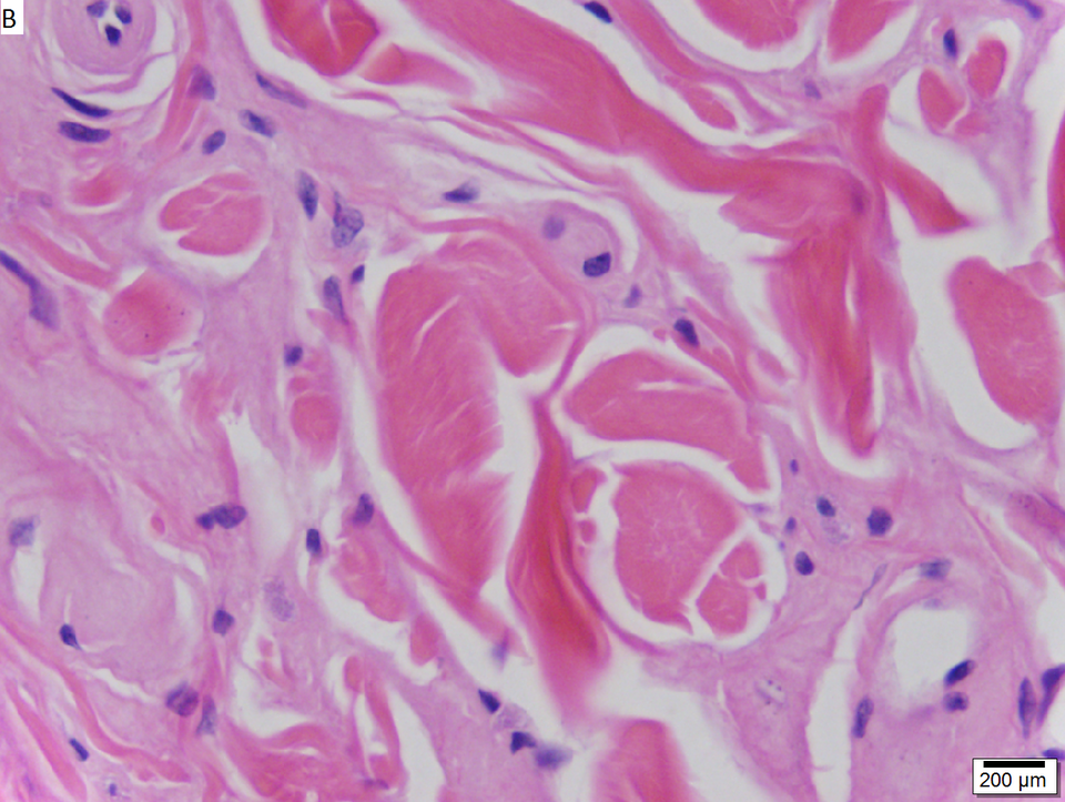 10 Rarest Diseases In The World - Oldest.org