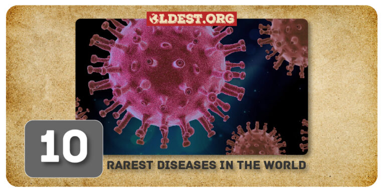 10 Rarest Diseases In The World - Oldest.org