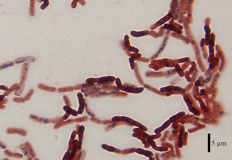 9 Largest Bacteria Ever Discovered - Oldest.org