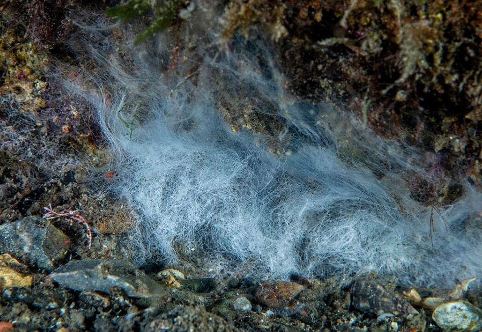 9 Largest Bacteria Ever Discovered - Oldest.org