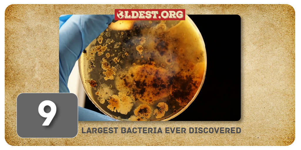9 Largest Bacteria Ever Discovered - Oldest.org