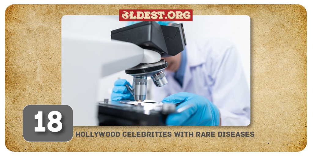 18 Hollywood Celebrities with Rare Diseases