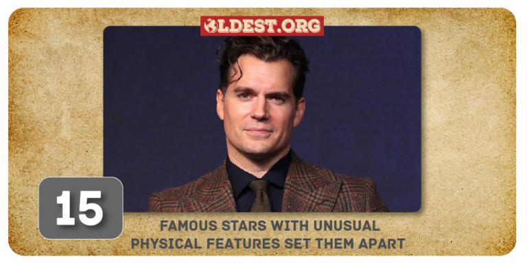 15 Famous Stars With Unusual Physical Features That Set Them Apart ...