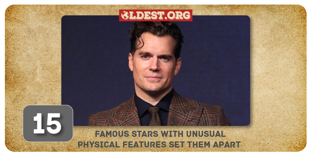 15 Famous Stars With Unusual Physical Features That Set Them Apart ...