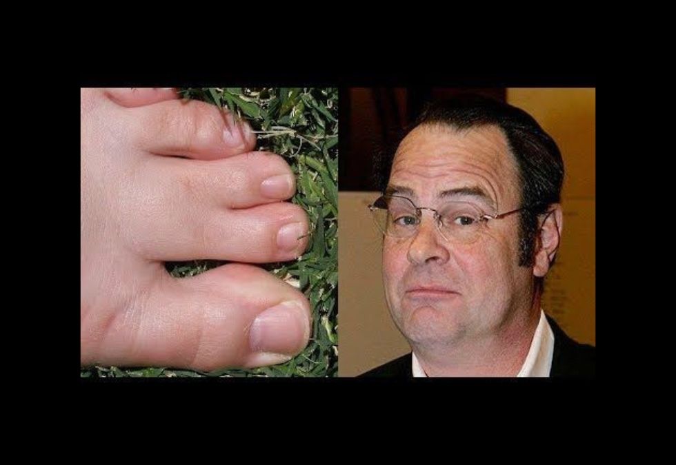 15 Famous Stars With Unusual Physical Features That Set Them Apart ...